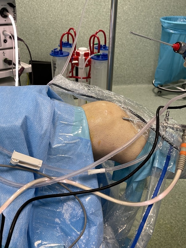 【Condromalacia Rotuliana】⇨ Causas, Síntomas y Tratamiento