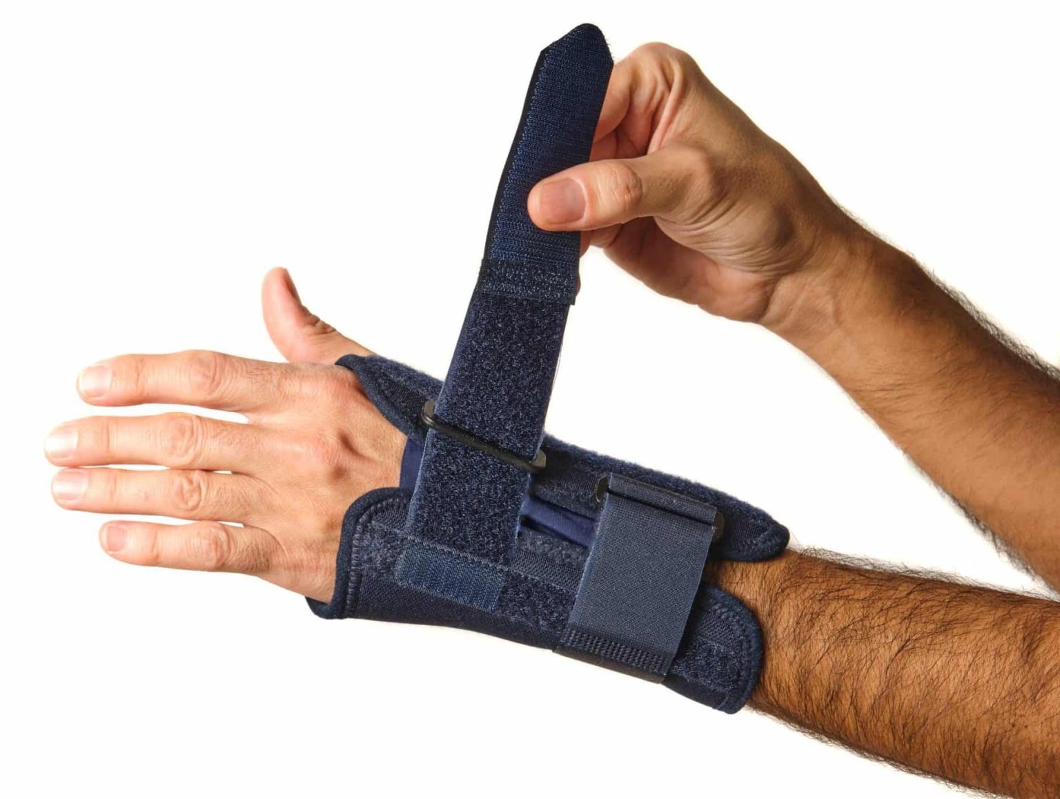 Fractura de escafoides - Traumadrid